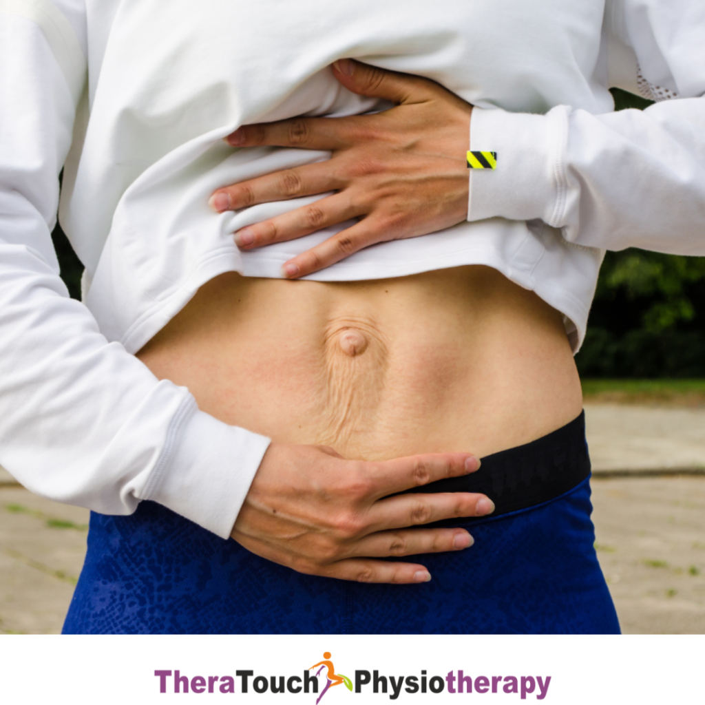 Abdominal Separation (Diastasis recti) - TheraTouch Physiotherapy